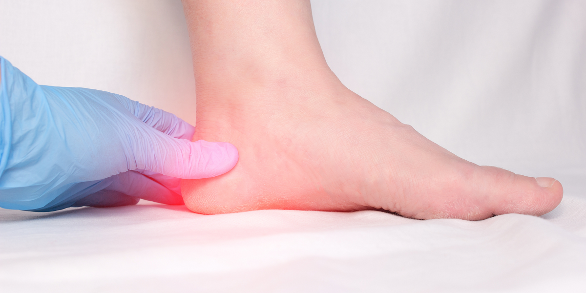 Heel Pain in Children: Everything About Sever's Disease | Stand Tall ...